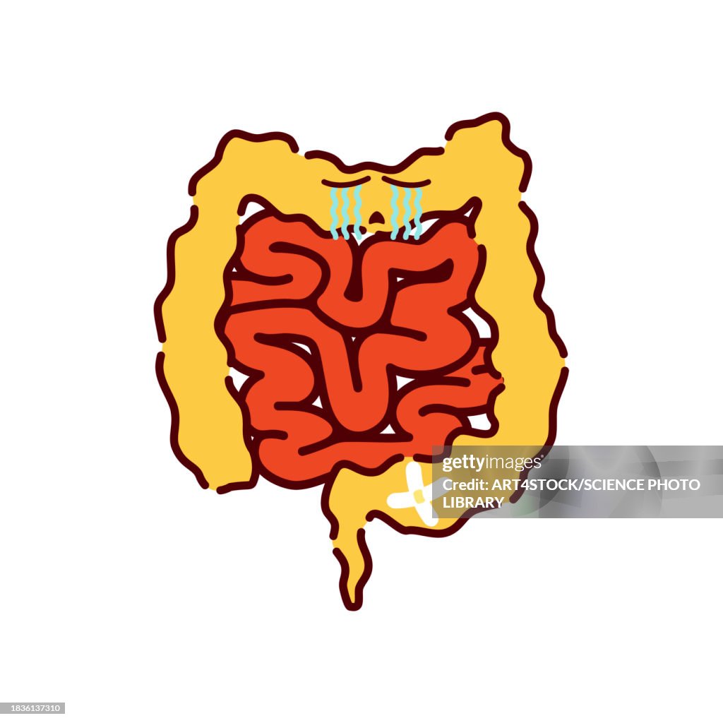 Ulcerative Colitis Conceptual Illustration High Res Vector Graphic Getty Images