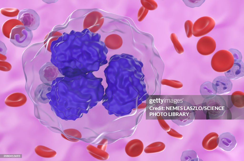 Follicular Lymphoma Cells Illustration High Res Vector Graphic Getty