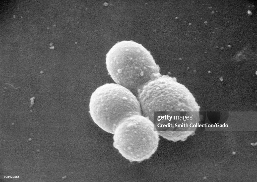 Scanning Electron Micrograph Of Malassezia Furfur Image Courtesy News Photo Getty Images