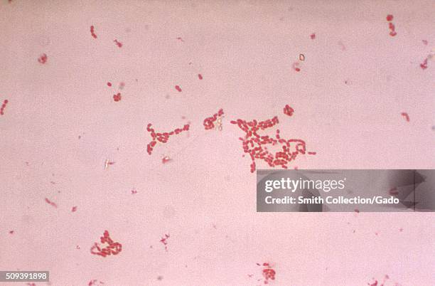 55 Acinetobacter Stock Photos, High-Res Pictures, and Images - Getty Images 55 Acinetobacter Stock Photos, High-Res Pictures, and Images - Getty Images