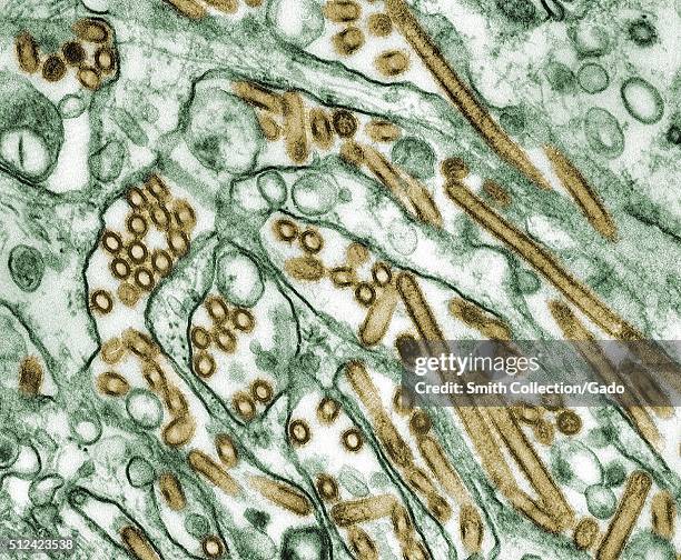 Colorized transmission electron micrograph of Avian influenza A H5N1 ... Colorized transmission electron micrograph of Avian influenza A H5N1 ...