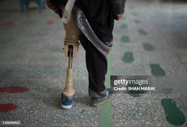 Girl Prosthetic Leg Photos And Premium High Res Pictures Getty Images