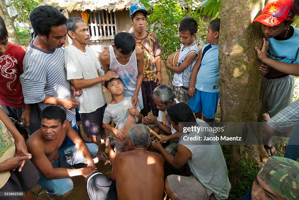 Circumcision In Rural Philippines Stock-Foto - Getty Images Circumcision In Rural Philippines Stock-Foto - Getty Images