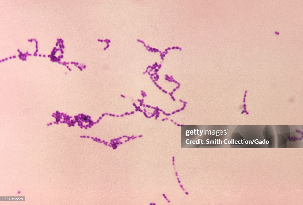 Streptococcus Pneumoniae Gram Stain
