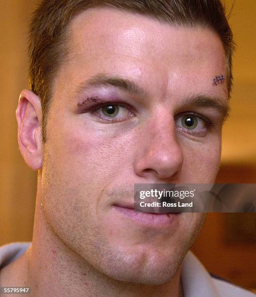 Human Knee Cap Photos And Premium High Res Pictures Getty Images