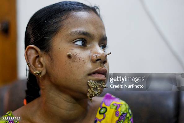 Doctors In Bangladesh Will Form A Medical Board To Assess A