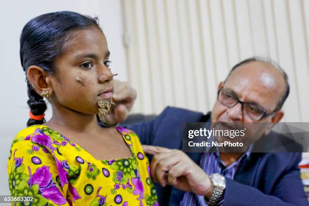Tree Man Syndrome A Rare Genetic Hereditary Skin Disorder Photos And