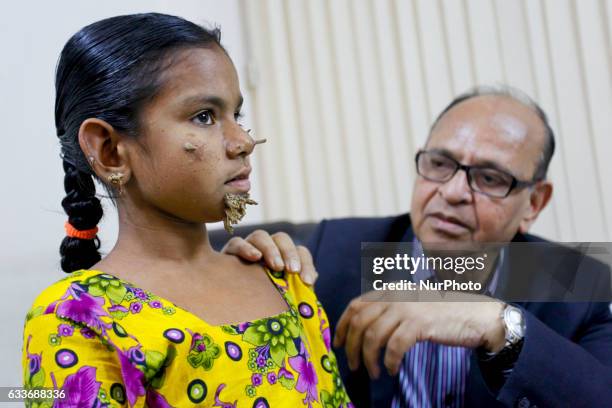 21 Tree Man Syndrome A Rare Genetic Hereditary Skin Disorder Stock