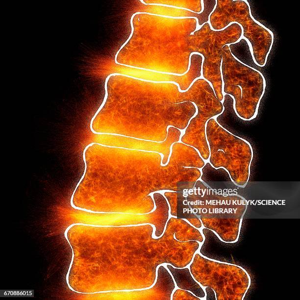 Human Spine Illustration High Res Vector Graphic Getty Images