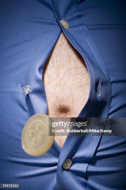 Distended Abdomen ストックフォトと画像 - Getty Images Distended Abdomen ストックフォトと画像 - Getty Images