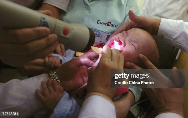 Cleft Lip Doctor Photos And Premium High Res Pictures Getty Images