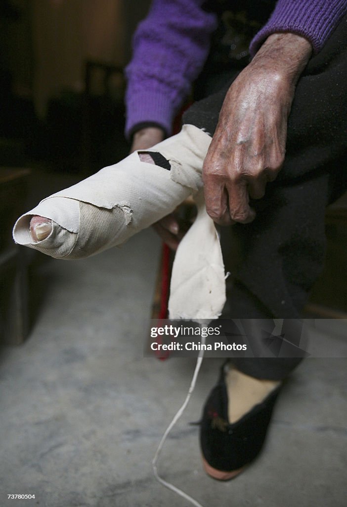 100 Year Old Bound Feet Woman Whose Surname Is Luo Pu Displays Her