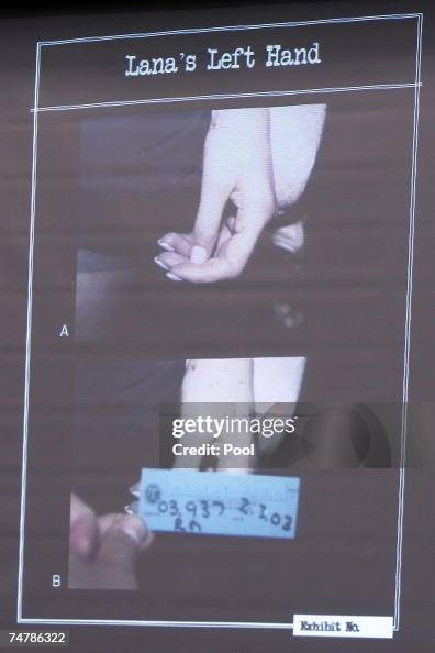 Projected crime scene evidence photos are displayed of Lana ... Projected crime scene evidence photos are displayed of Lana ...