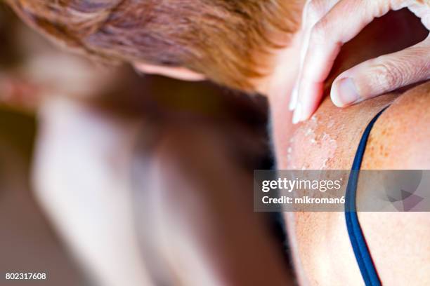Mature Woman Rash Stock Fotos Und Bilder Getty Images