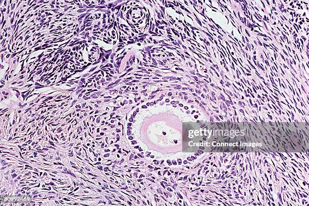 Ovary Pattern Photos And Premium High Res Pictures Getty Images