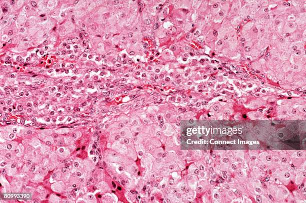 Ovary Cells Photos And Premium High Res Pictures Getty Images