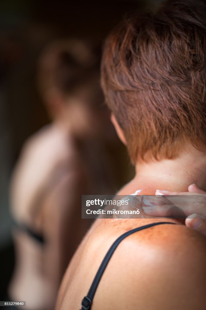 Woman Looking In Mirror To See Sunburned Skin On Shoulder That Peeling