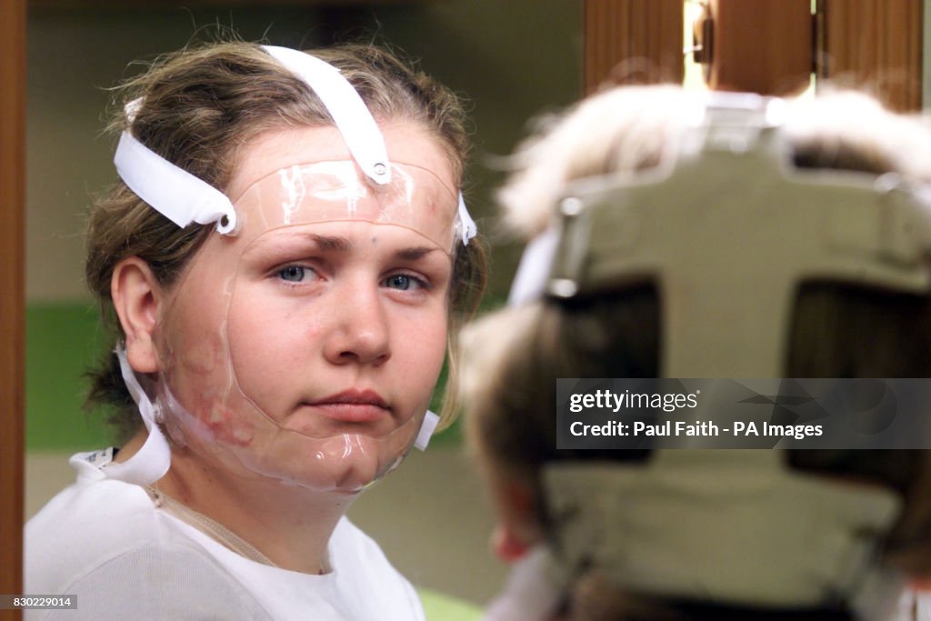 Una McGurk aged fifteen from Omagh, Una was seriously injured in the ... Una McGurk aged fifteen from Omagh, Una was seriously injured in the ...