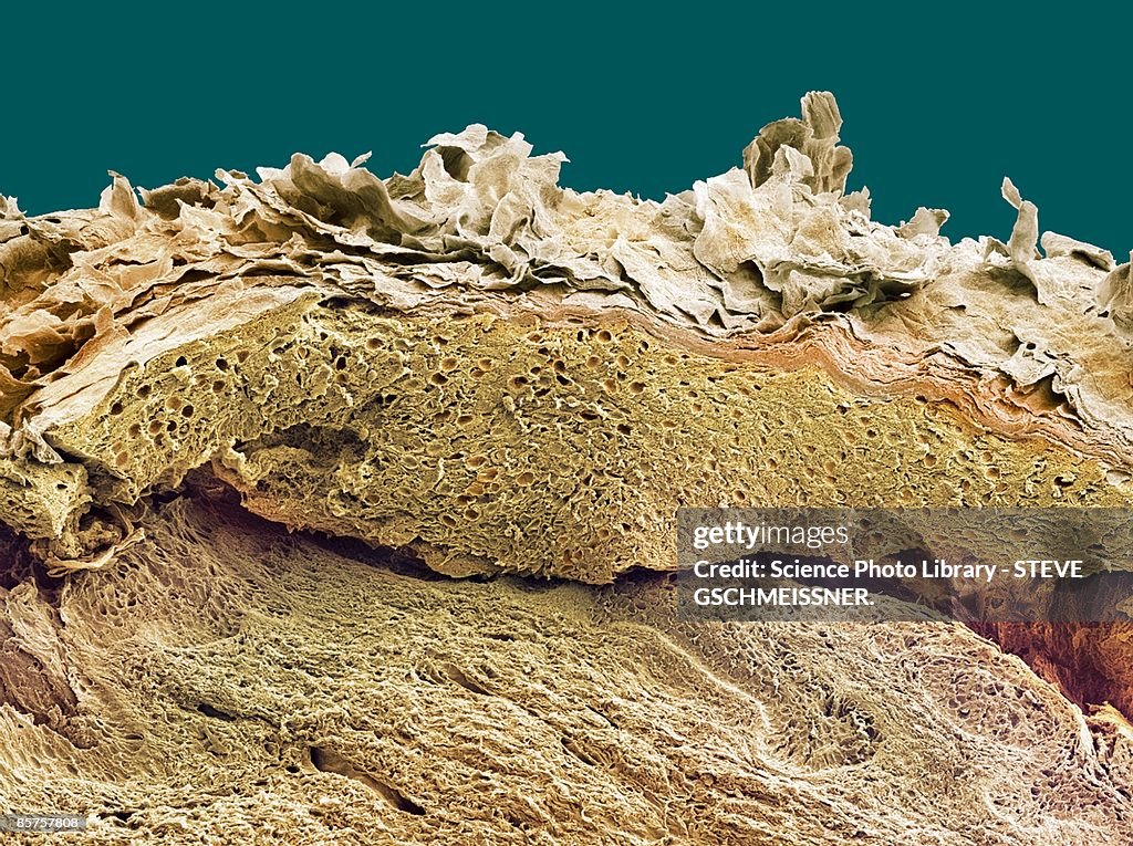 Colored Scanning Electron Micrograph Of Section Through Healthy Skin