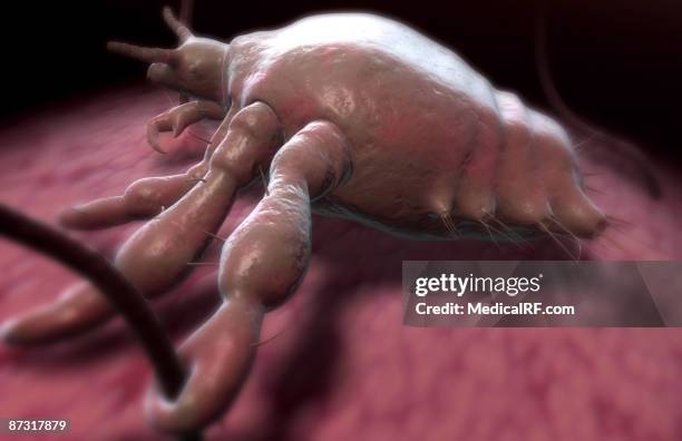 Pubic Crabs Photos And Premium High Res Pictures Getty Images