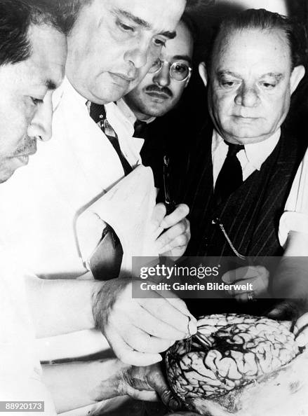 Doctors examine the brain of assassinated Russian revolutionary Leon ... Doctors examine the brain of assassinated Russian revolutionary Leon ...