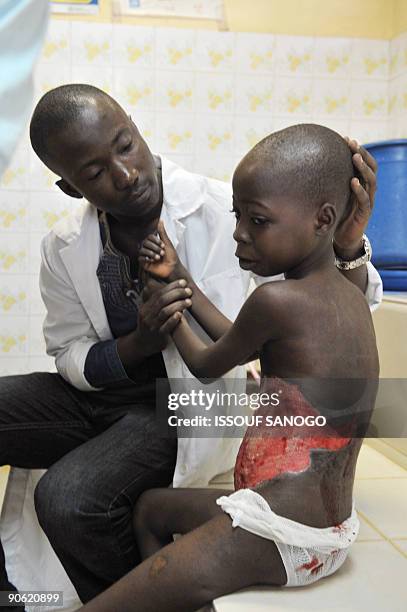 49 Buruli Ulcer Photos & High Res Pictures - Getty Images 49 Buruli Ulcer Photos & High Res Pictures - Getty Images