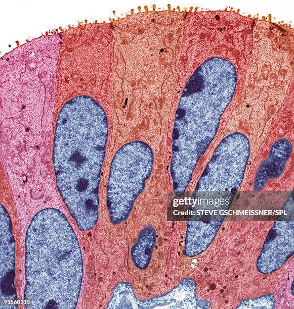 153 Electron Micrograph Nucleus Stock Photos, High-Res Pictures, and ... 153 Electron Micrograph Nucleus Stock Photos, High-Res Pictures, and ...