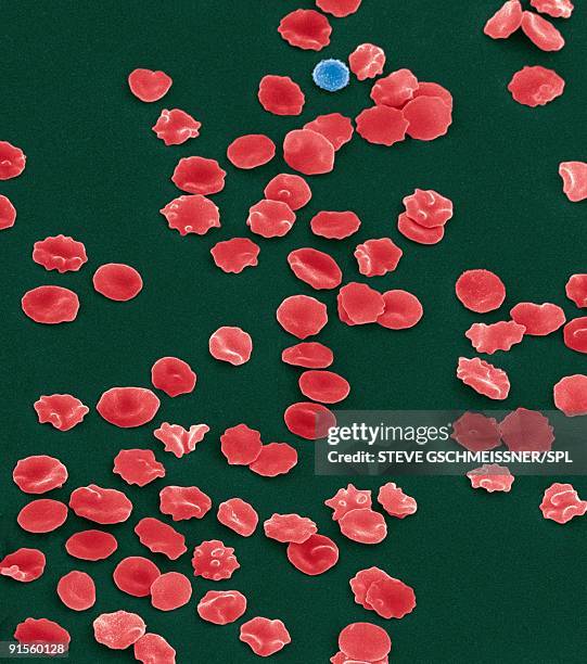 27 White Blood Cells Sem High Res Illustrations - Getty Images 27 White Blood Cells Sem High Res Illustrations - Getty Images