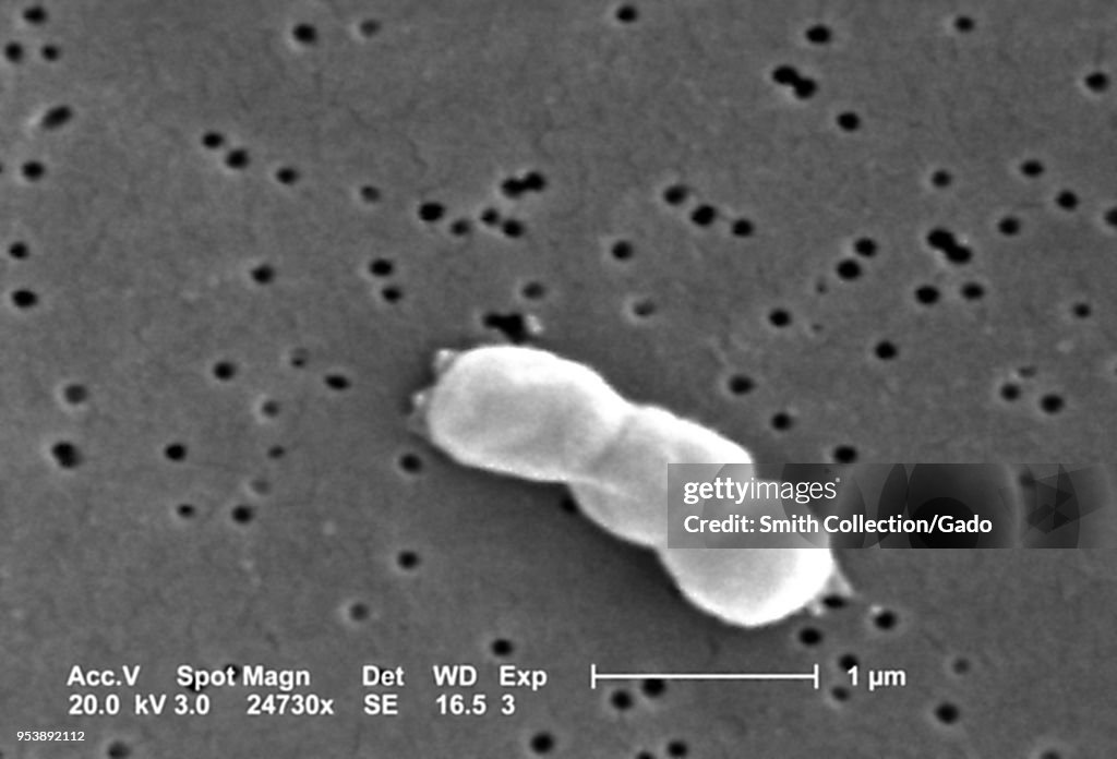 Gram-negative, non-motile Acinetobacter baumannii bacteria revealed ... Gram-negative, non-motile Acinetobacter baumannii bacteria revealed ...
