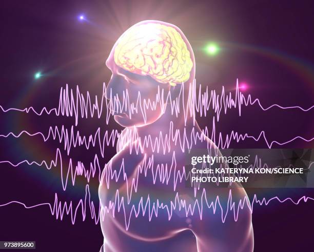182 Epilepsy Brain Waves Stock Photos, High-Res Pictures, and Images ... 182 Epilepsy Brain Waves Stock Photos, High-Res Pictures, and Images ...
